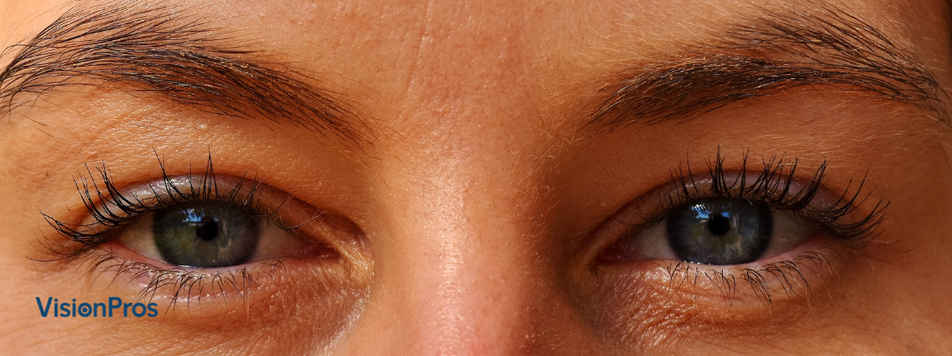 Why Do My Contacts Feel Dry? (And How to Fix It)